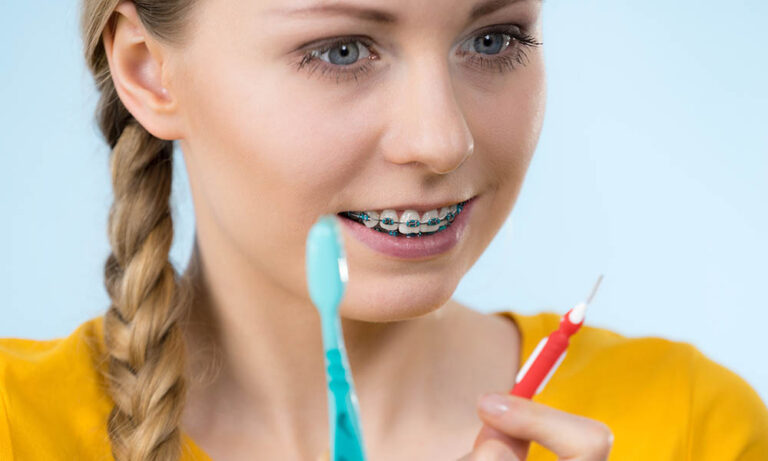 How to Brush and Floss Your Teeth When You Have Braces - Paschal ...